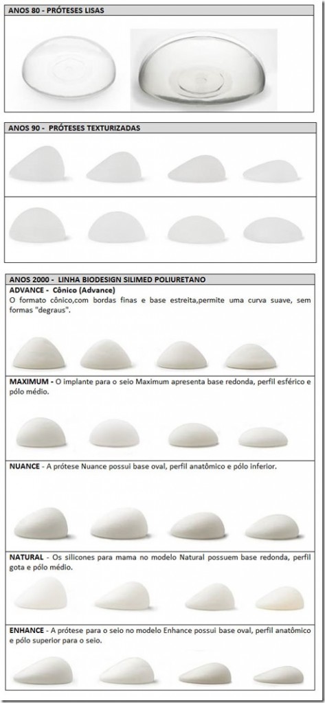 Meus, Lindos e Pagos! » Arquivos » Cinquenta anos de evolução do silicone