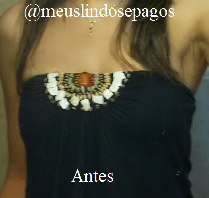 Meus, Lindos e Pagos! » Arquivos » Mastopexia + prótese 300ml Silimed